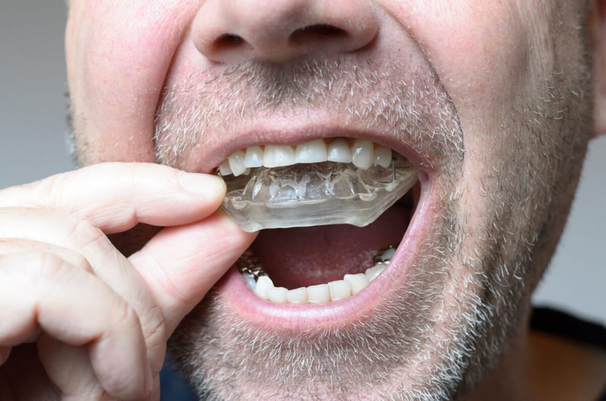 Teeth Guard Teeth Guard